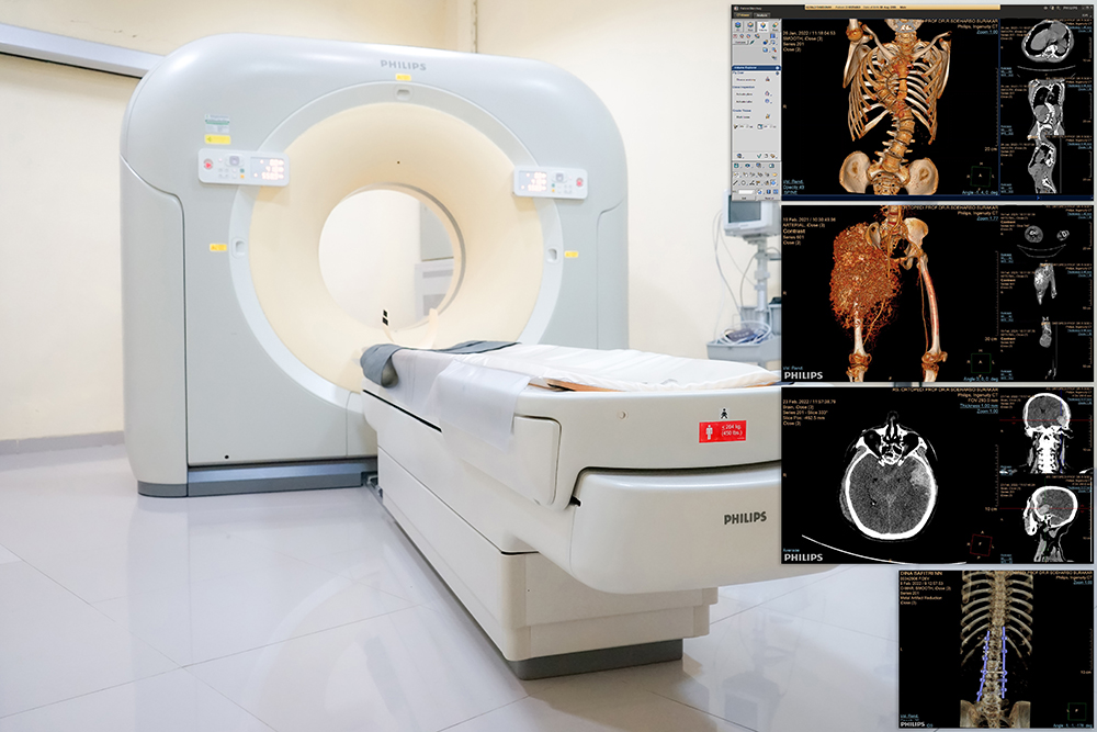 Radiologi - Rumah Sakit Ortopedi Soeharso Surakarta